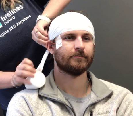 How to Perform the Perfect EEG Head Wrap - Lifelines Neuro